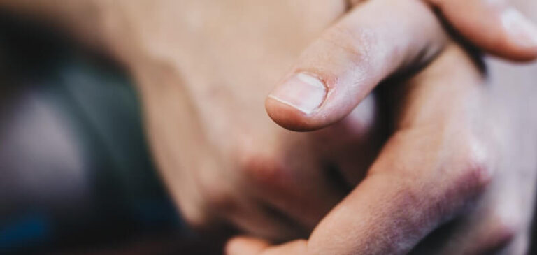 Kusta: Gejala, Penyebab, dan Pengobatan - Farmaku.com