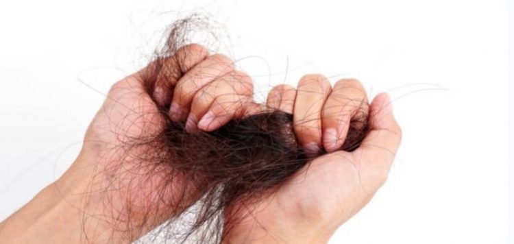 11 Rekomendasi Shampo untuk Rambut Rontok dan Ketombe